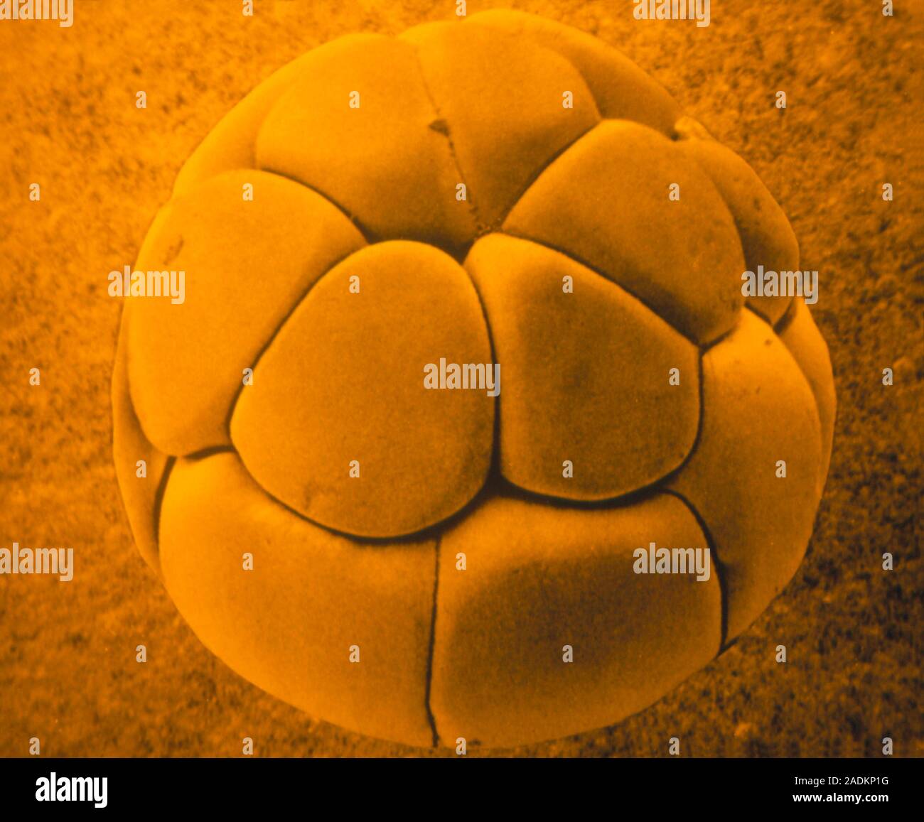 False-colour scanning electron micrograph (SEM) of a frog embryo at the ...