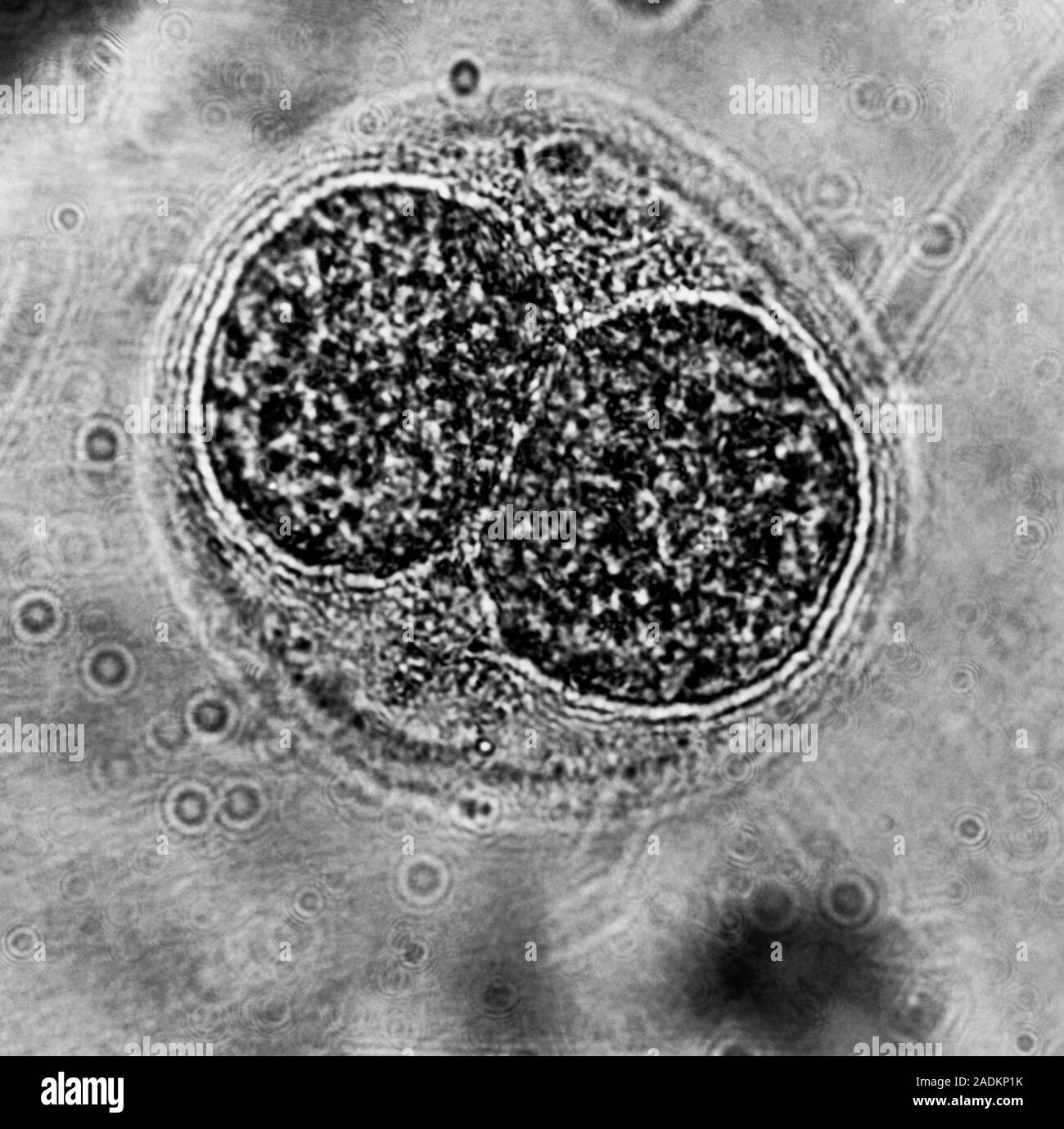 Light micrograph of a mouse embryo, taken at the end of the first ...