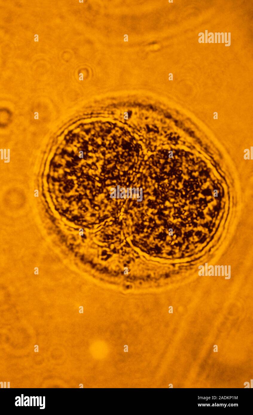 False colour light micrograph of a mouse embryo, taken at the end of ...
