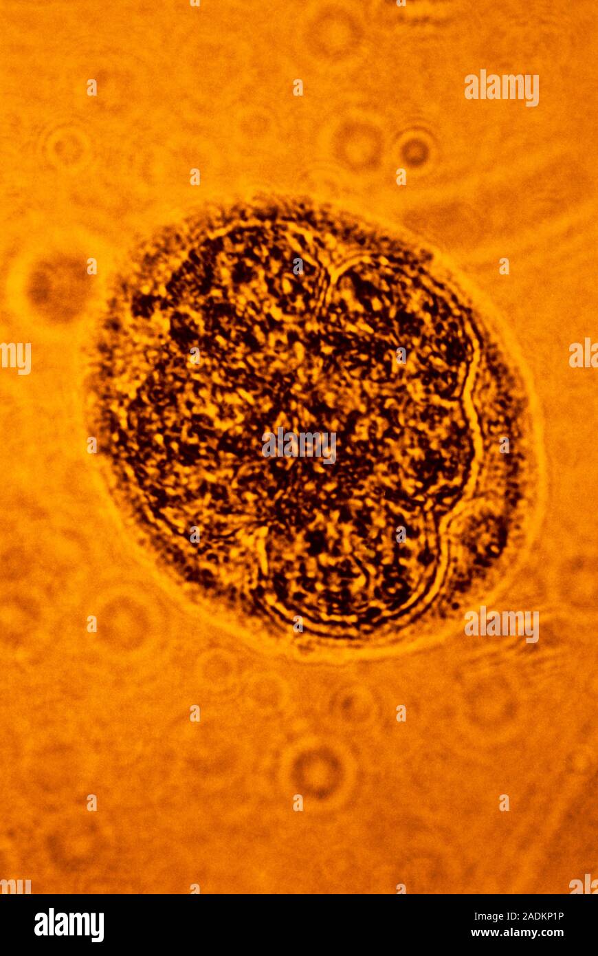 False colour light micrograph of a mouse embryo, taken at the beginning ...