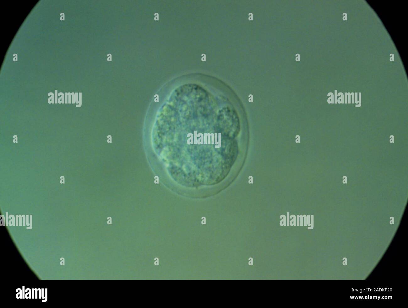 Light micrograph of the embryo of a mouse at the eight-cell stage. The ...