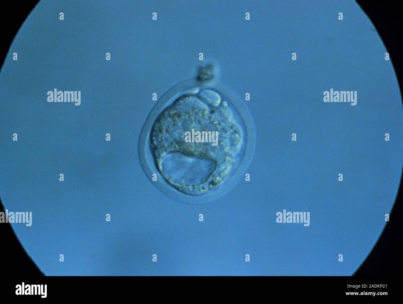 Light micrograph of the embryo of a mouse seen at the blastocyst stage ...