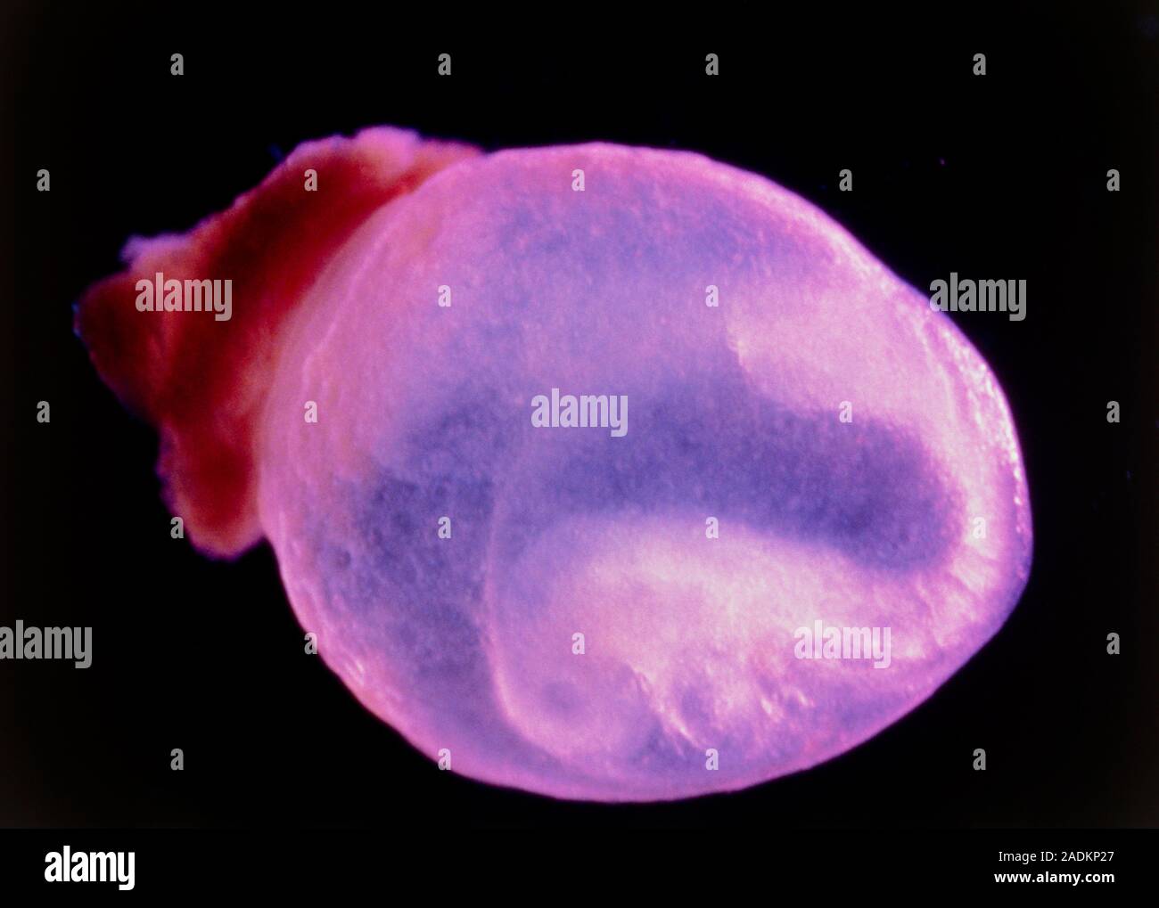 Macrophotograph of a 10.2 day old foetus of a rat. The foetus lies ...