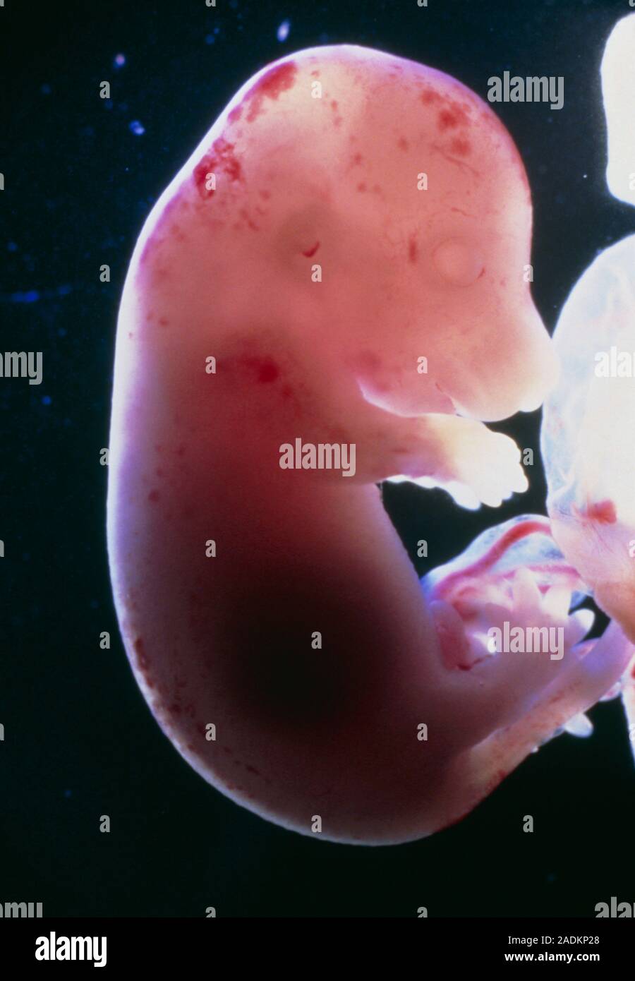 Macrophotograph of a 17.5 day old foetus of a rat still linked to the ...