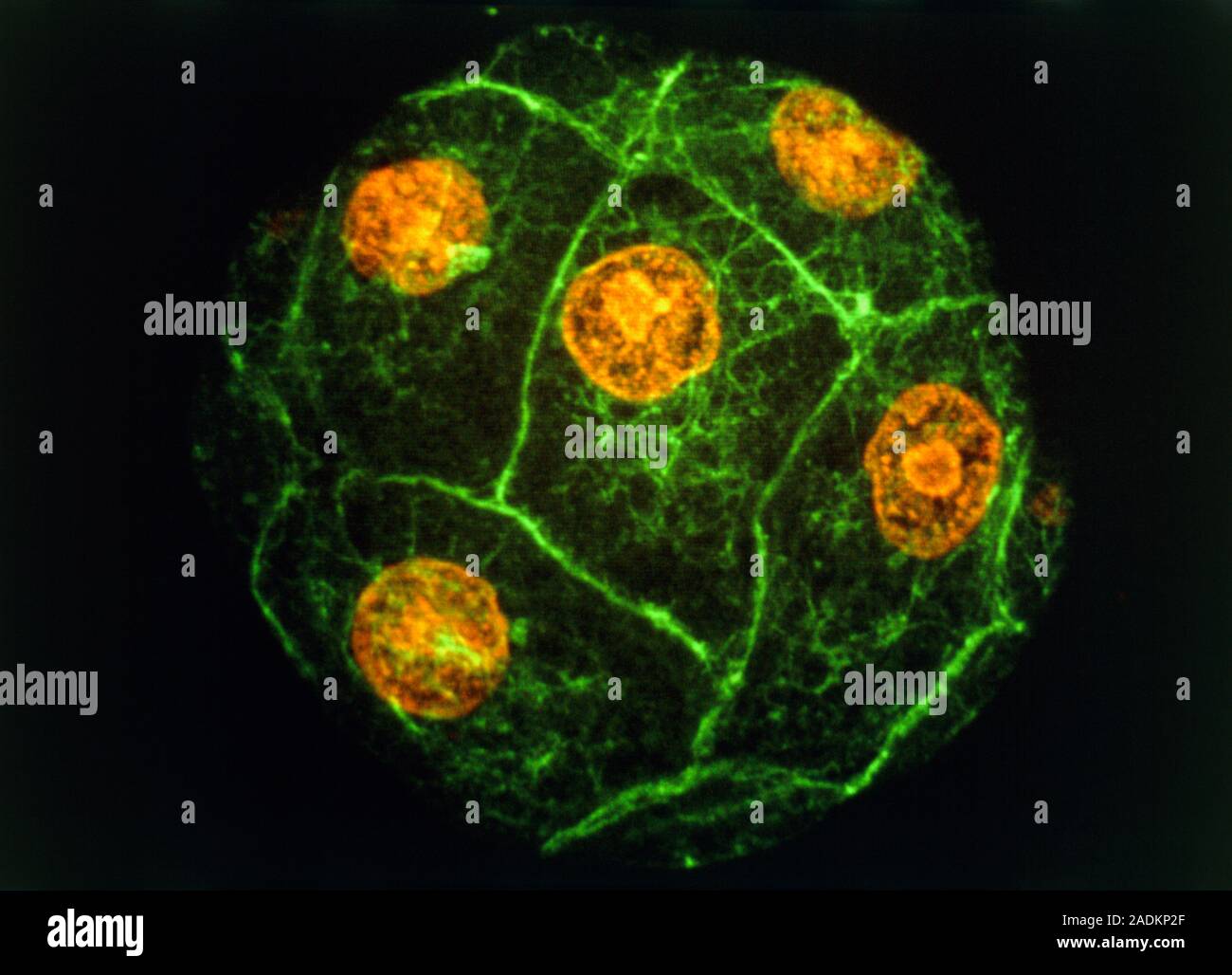 Sea urchin embryo. Immunofluorescence micrograph of a sea urchin embryo ...