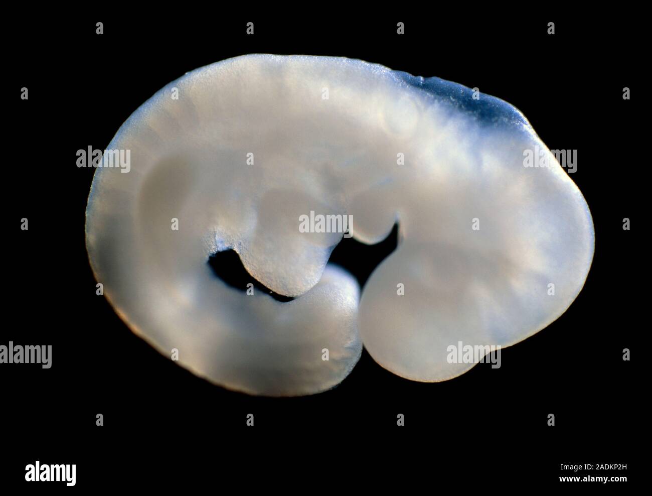 Mouse embryo. Light micrograph of a 9.5 day old embryo removed from the ...