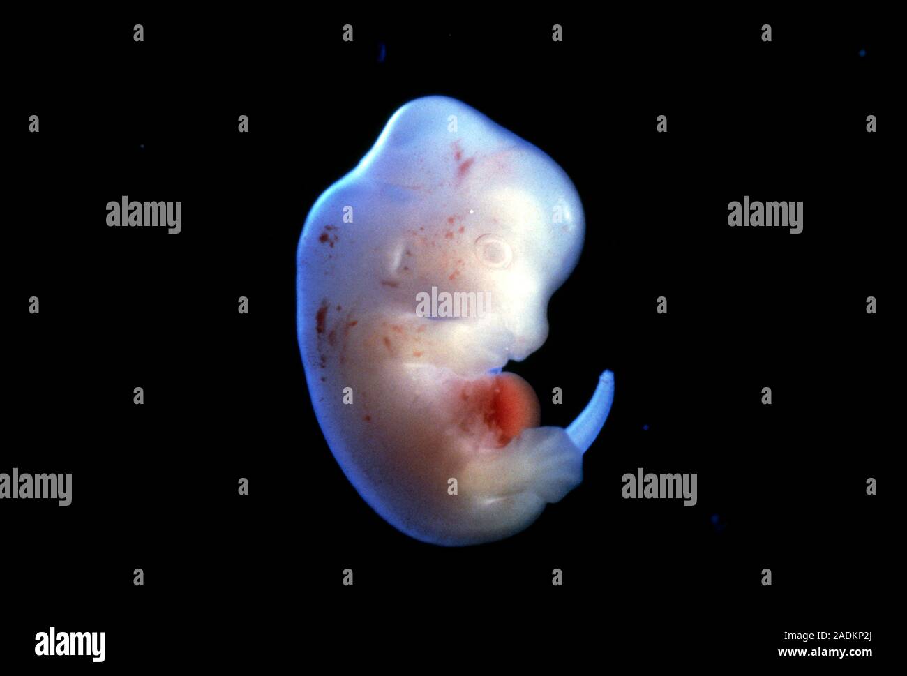 Rat embryo (15.5 days). Close-up of a rat embryo at 15.5 days gestation ...