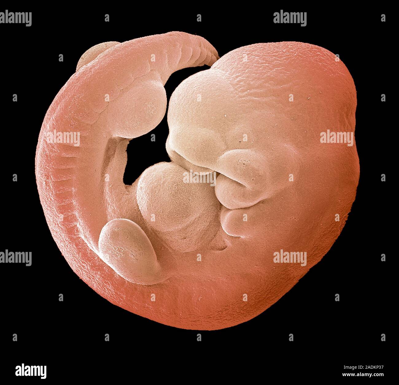 Mouse foetus. Coloured scanning electron micrograph (SEM) of a 17-day ...