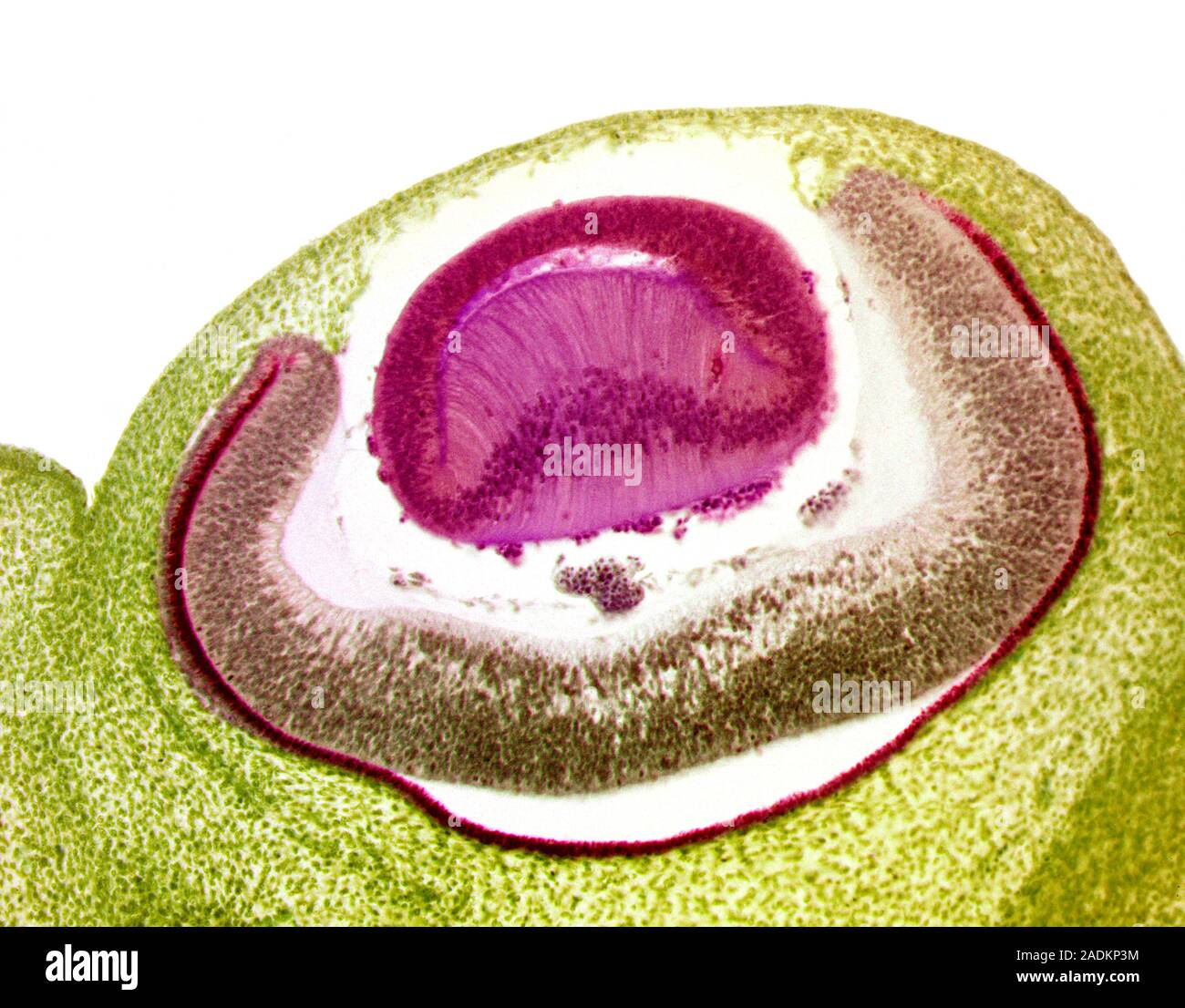 Developing pig eye. Coloured light micrograph of the eye of a 20mm pig ...