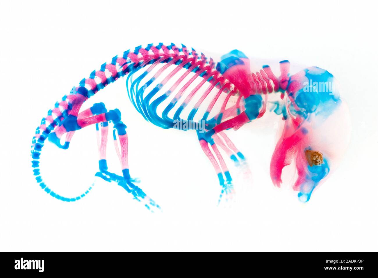 Mouse embryo skeleton, light micrograph. This specimen was prepared ...