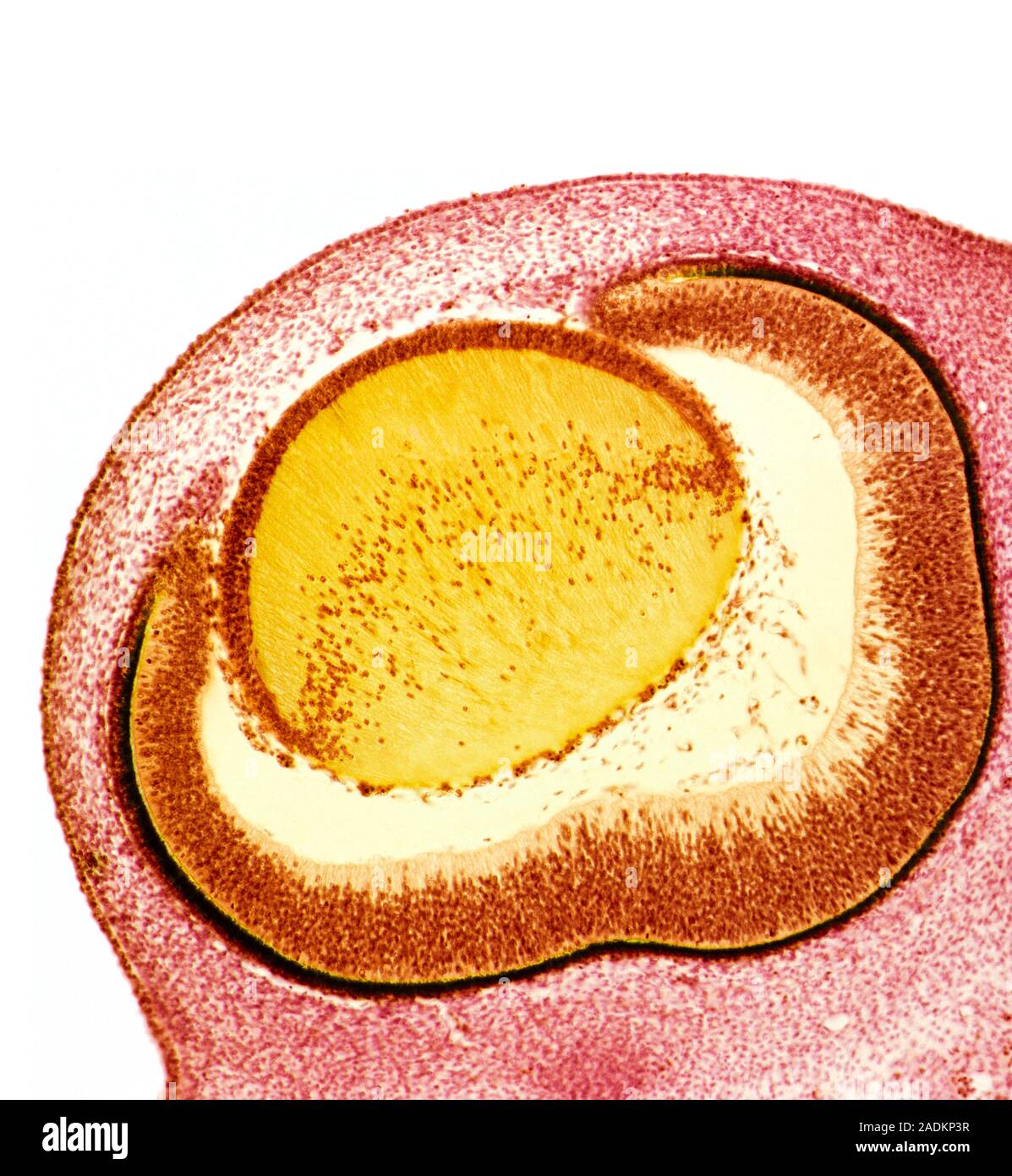 Developing pig eye. Coloured light micrograph of the eye of a 20mm pig ...