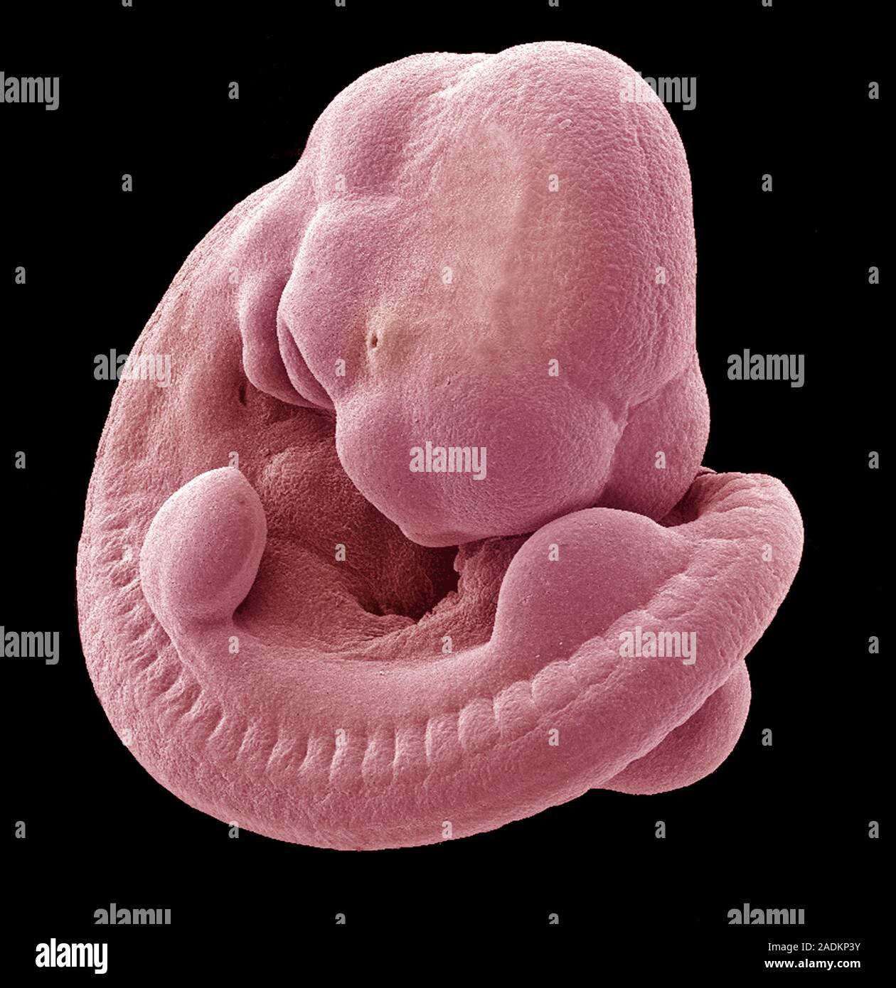 Mouse foetus. Coloured scanning electron micrograph (SEM) of a mouse ...