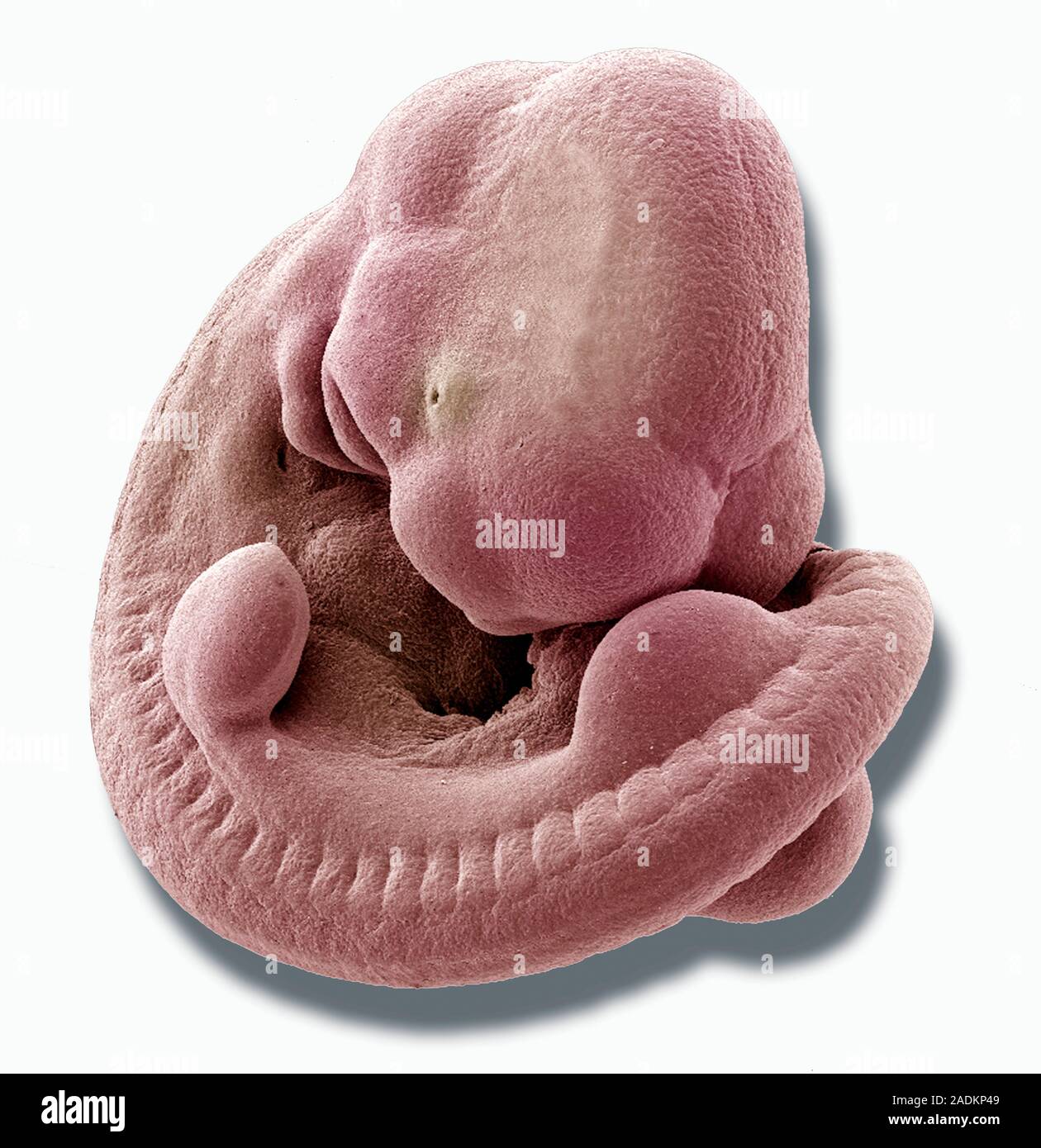 Mouse foetus. Coloured scanning electron micrograph (SEM) of a mouse ...