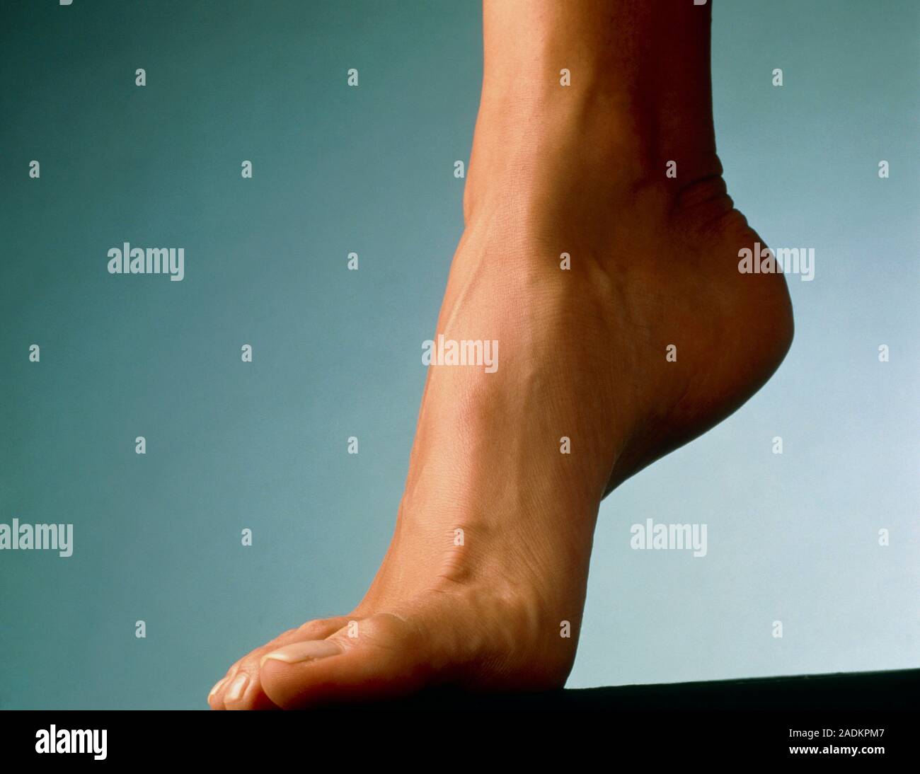 Healthy foot. Close-up of the foot of a woman, raised onto its toes ...