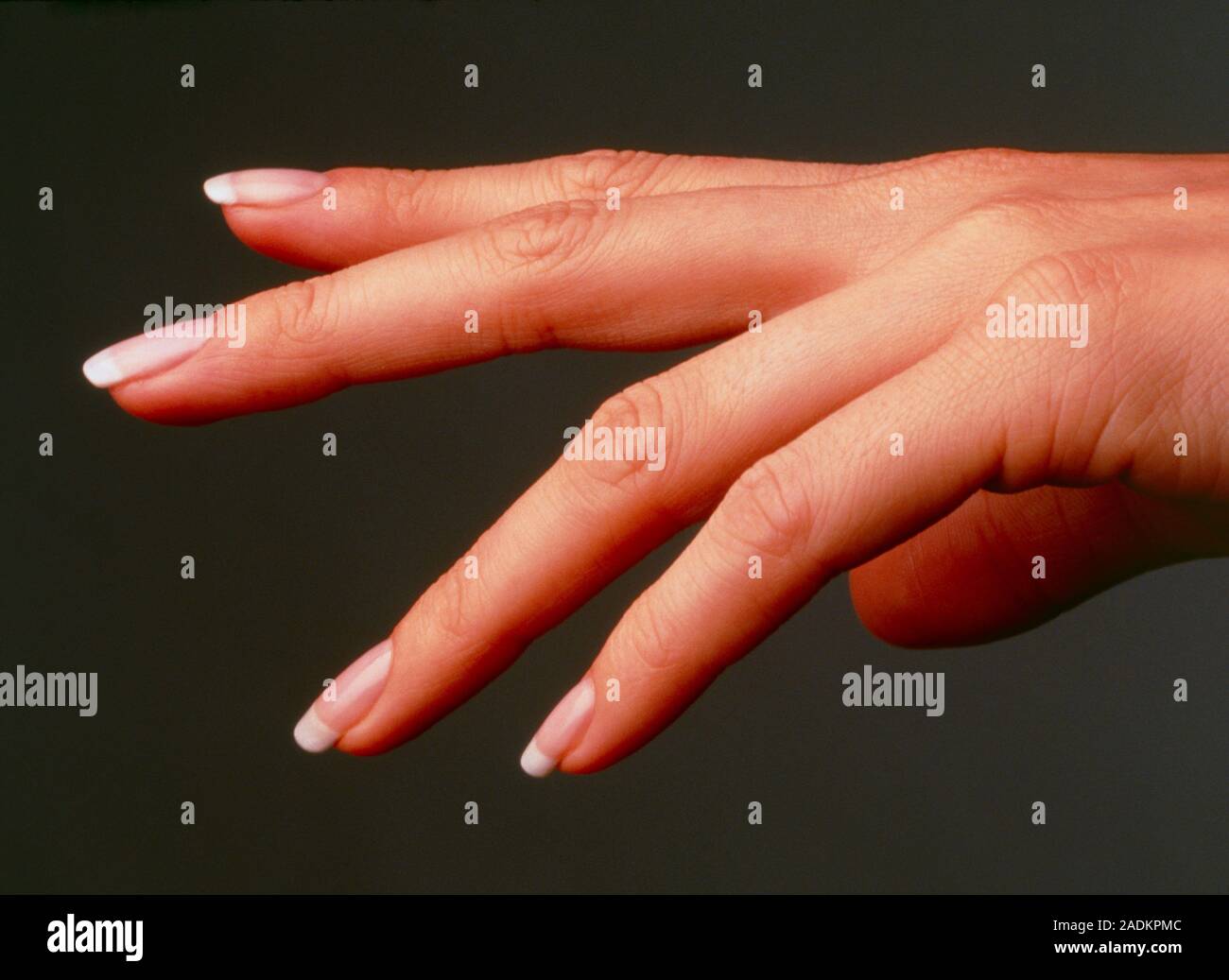 Healthy hand. Side view of the hand of a woman, with fingers spread out ...