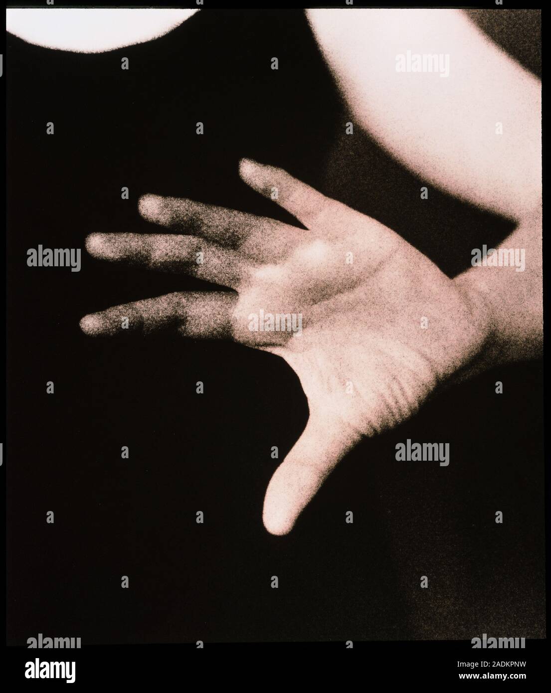 Healthy hand. Hand of a woman held out, palm- facing forward, with ...