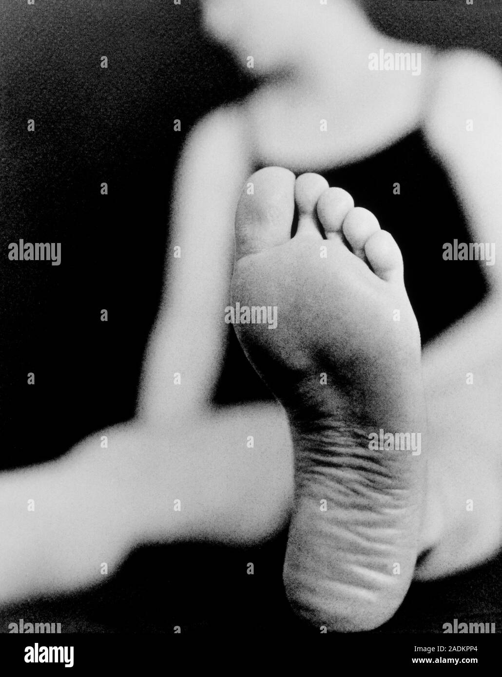 Sole of the foot. Ventral view of the foot of a seated woman showing ...