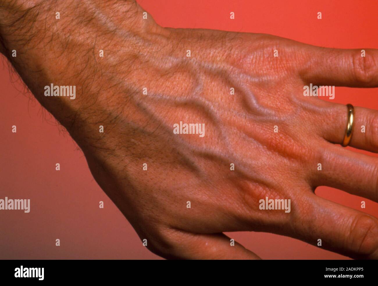 Hand. Man's healthy hand with a network of veins seen Stock Photo - Alamy