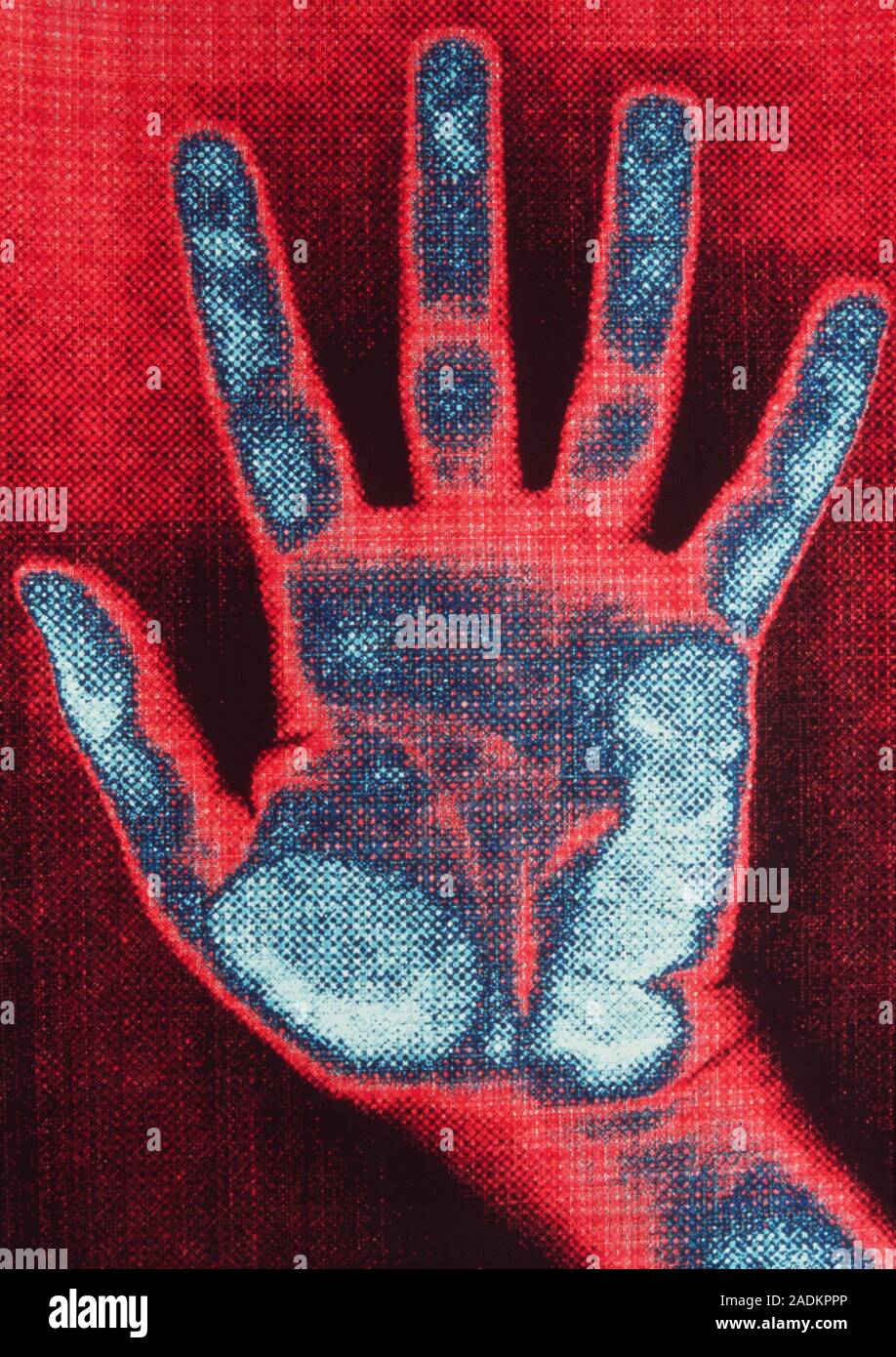 Hand, computer-enhanced image Stock Photo - Alamy