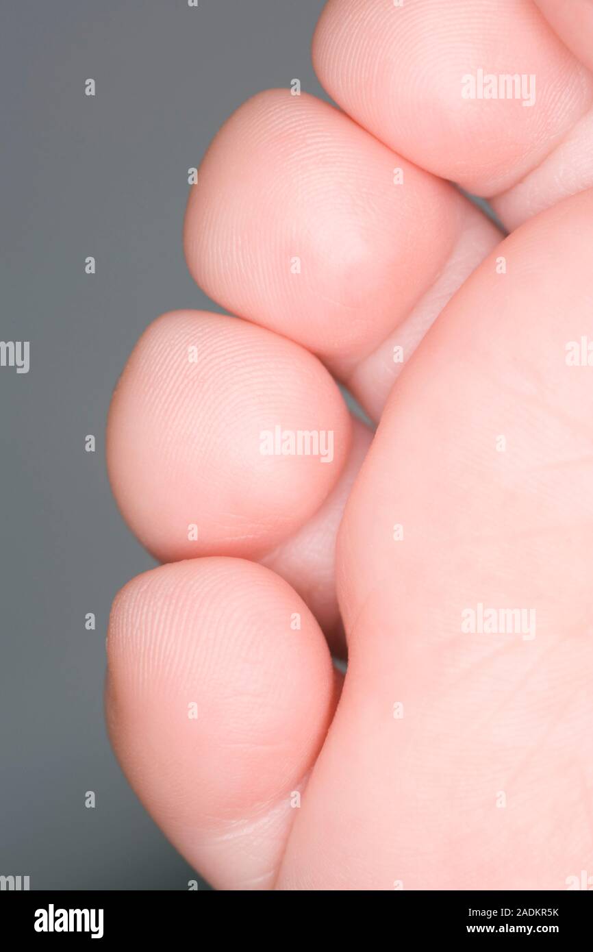 MODEL RELEASED. Child's toes Stock Photo - Alamy