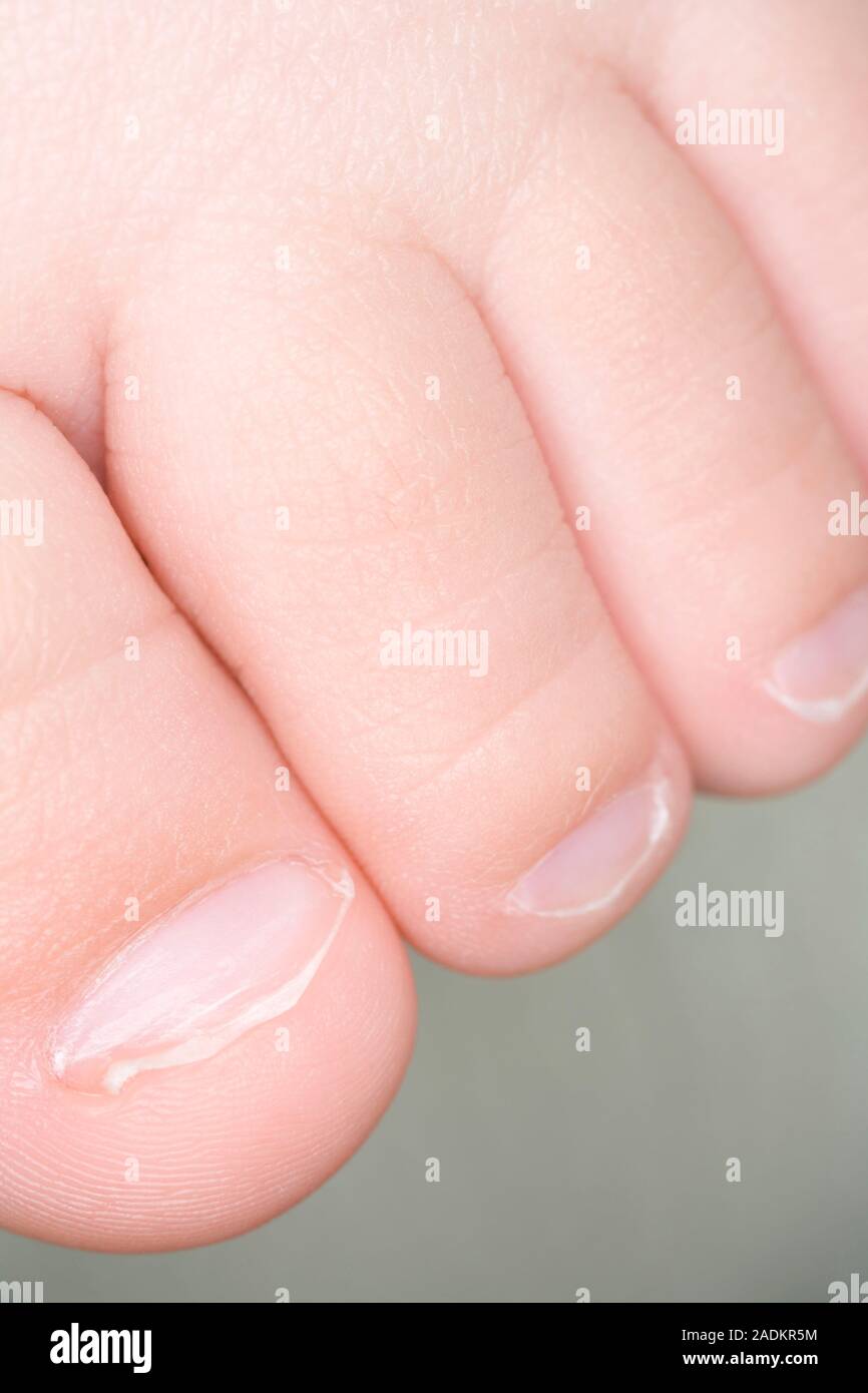 MODEL RELEASED. Child's toes Stock Photo - Alamy