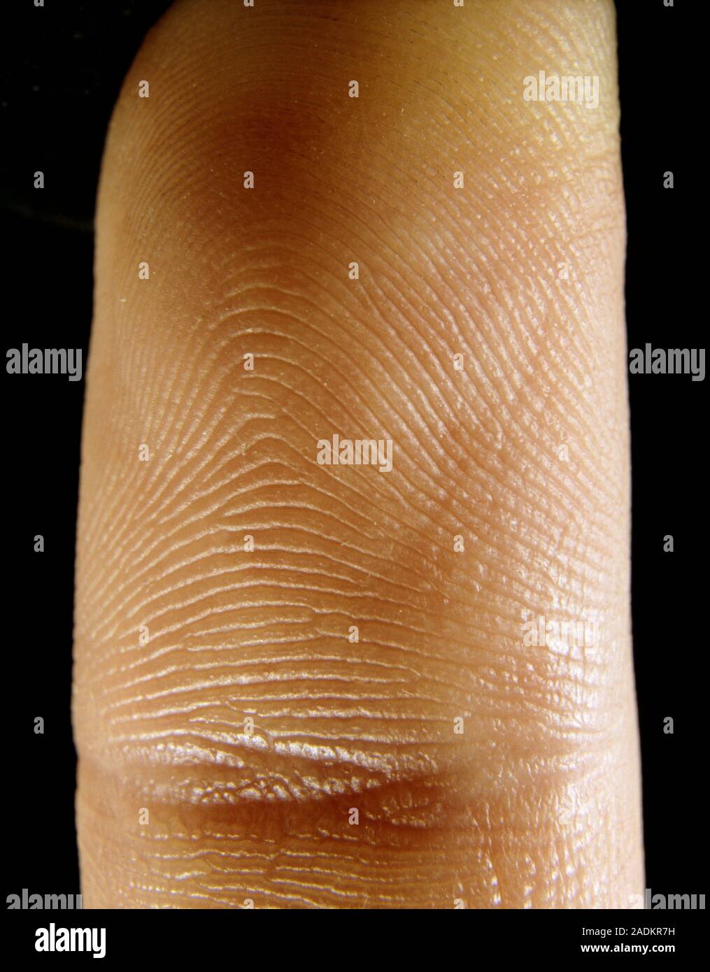 Close up of the skin surface of the index finger Stock Photo - Alamy