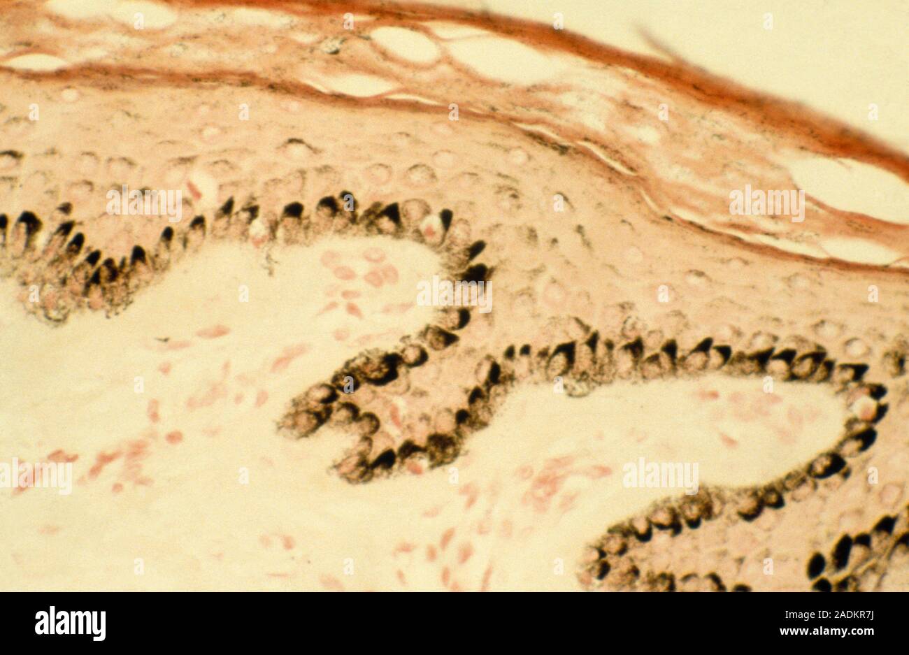 Light micrograph of a section through normal human (caucasian) skin ...