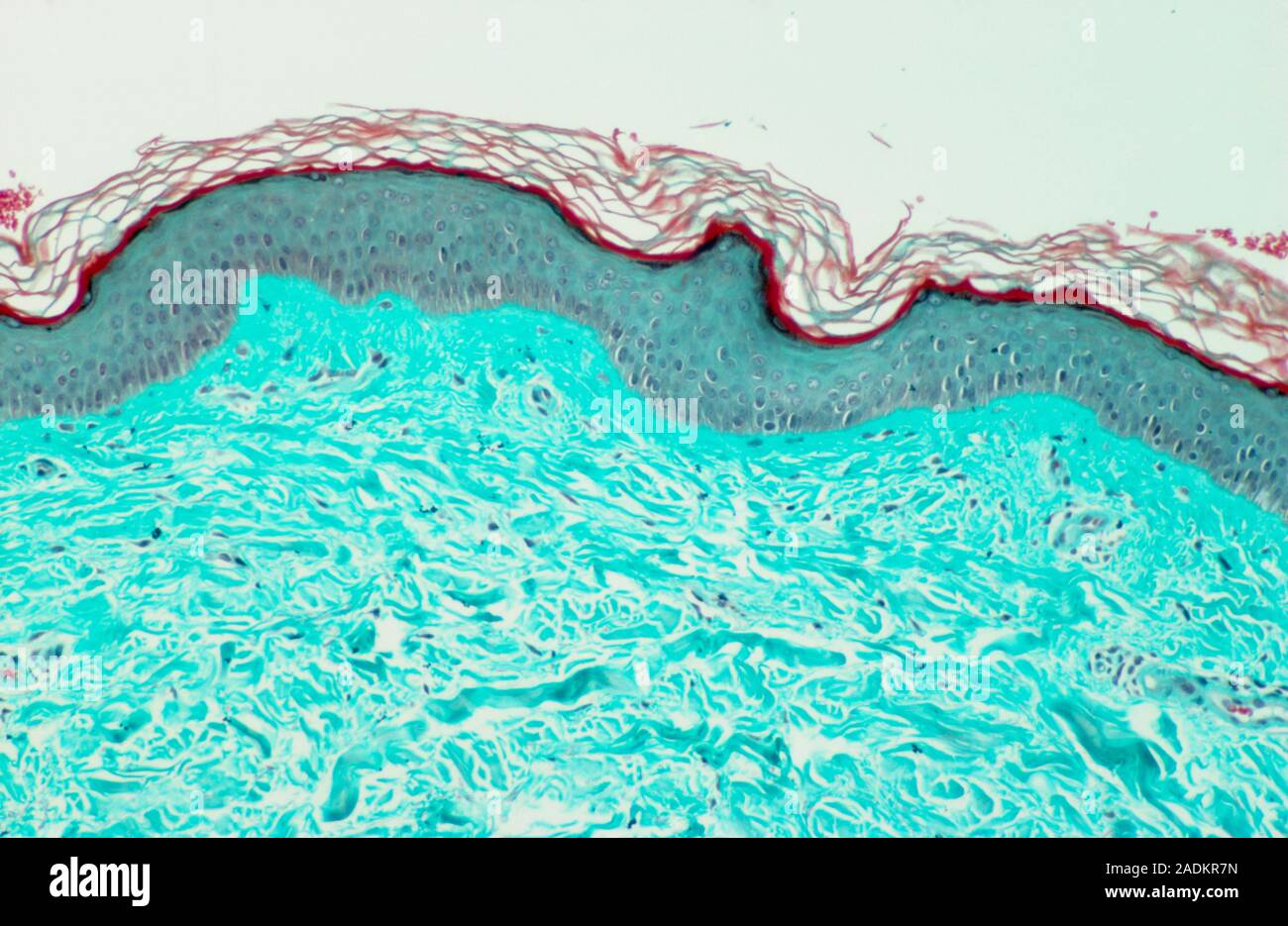 Photomicrograph of a section of normal human skin (taken from vicinity ...