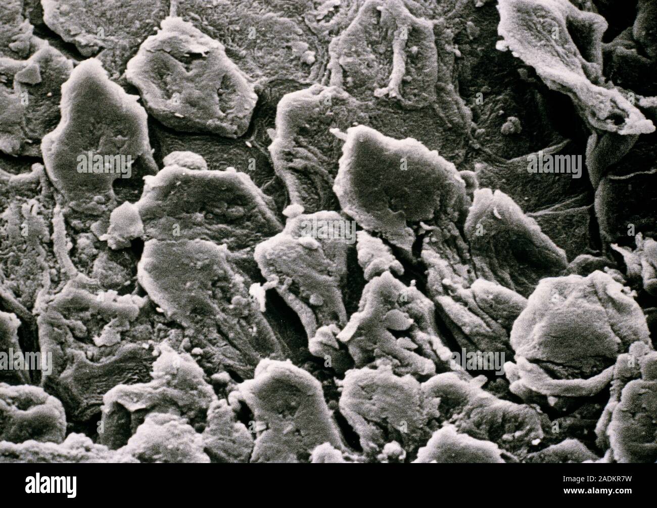 Scanning electron micrograph (SEM) of the overlapping, squamous cells ...