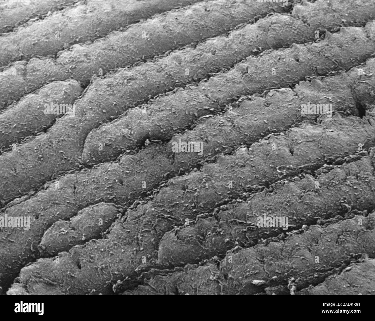 Scanning Electron Micrograph (SEM) of the sole of the human foot ...
