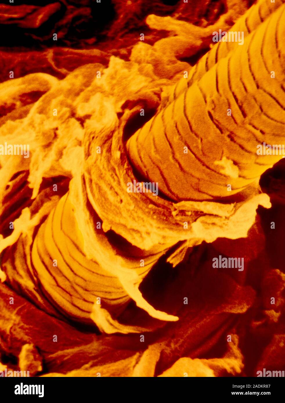 False-colour scanning electron micrograph (SEM) of the surface of human ...