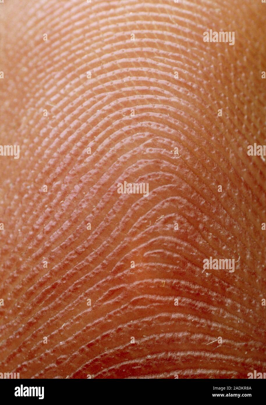 Macrophotograph of the index finger of a young male human showing ...