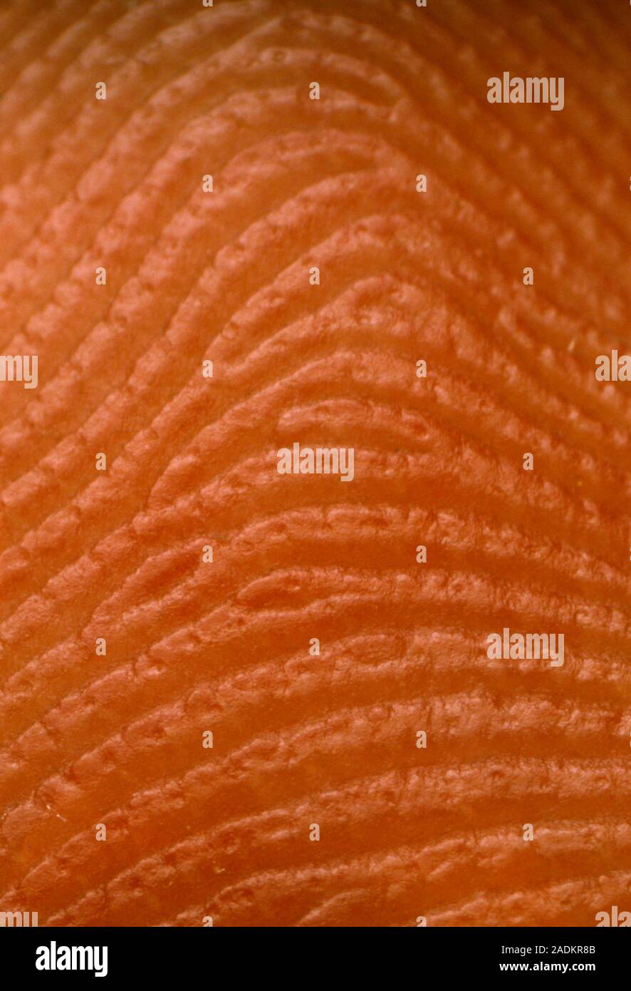 Macrophotograph of the index finger of a young male human showing ...