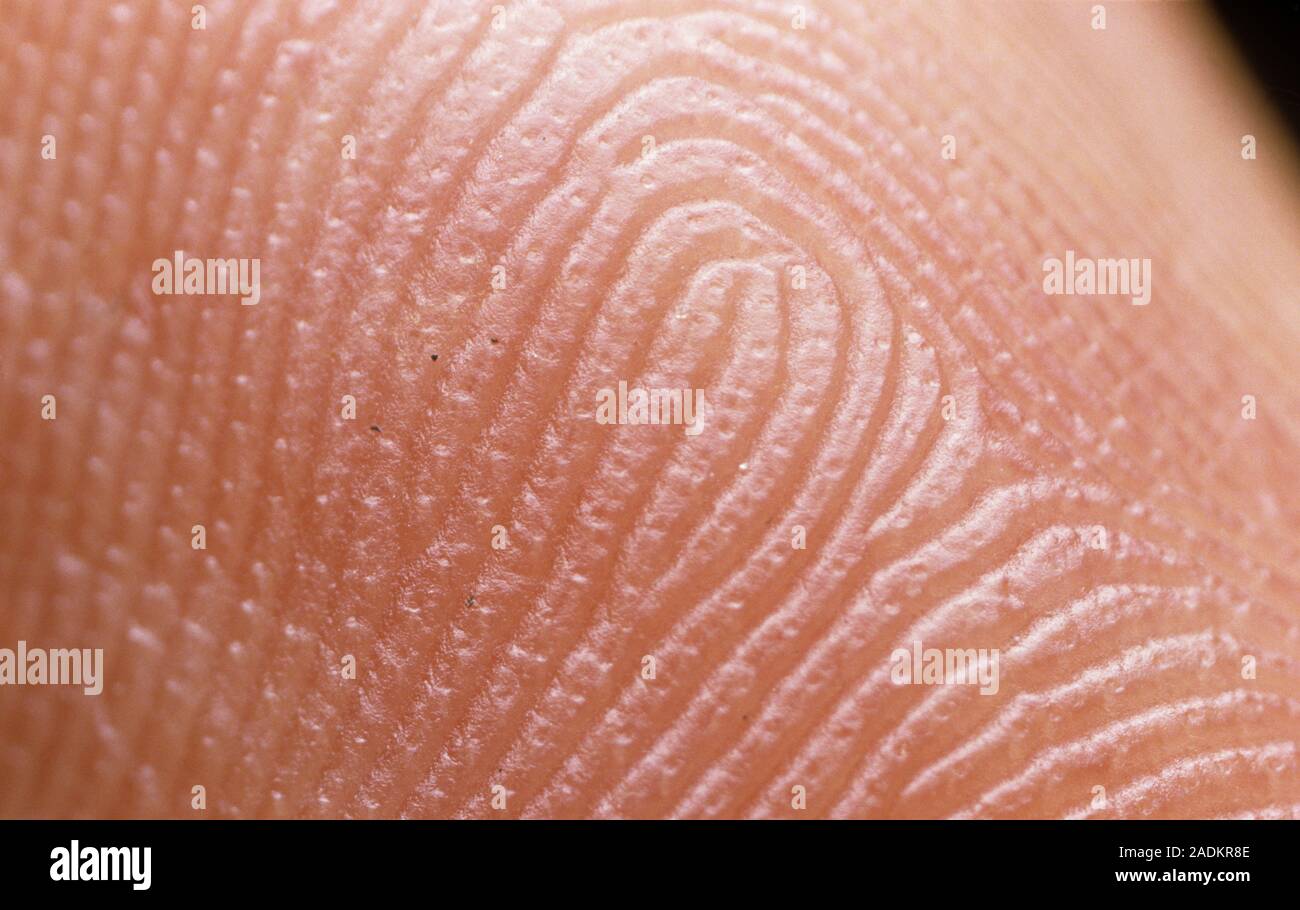 Macrophotograph of the index finger of a young male human showing ...