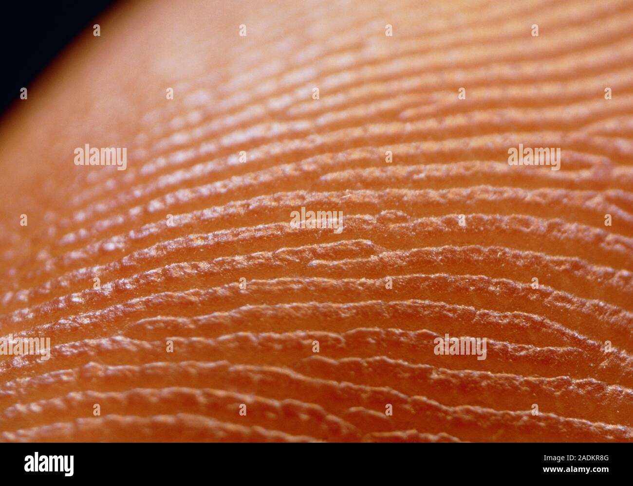 Macrophotograph of the index finger of a young male human showing ...