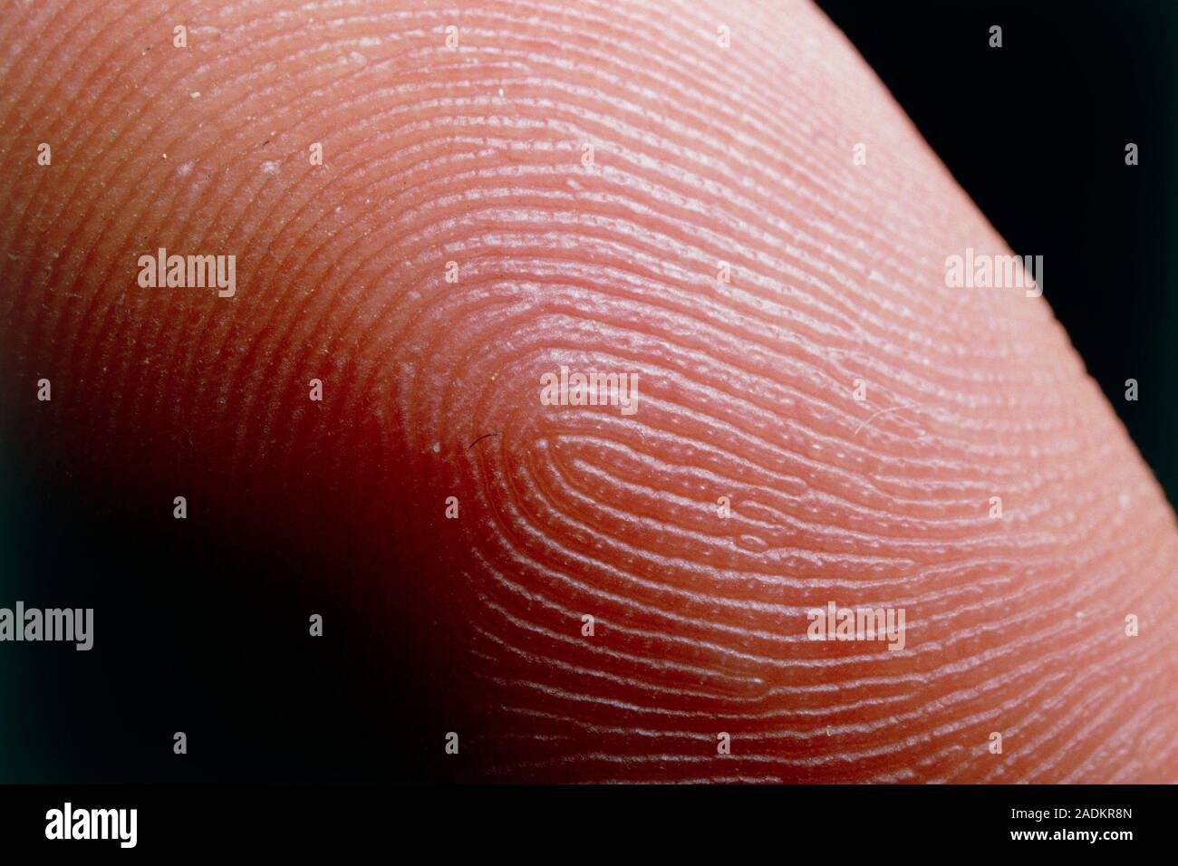 Macrophotograph of the index finger of a young male human showing ...