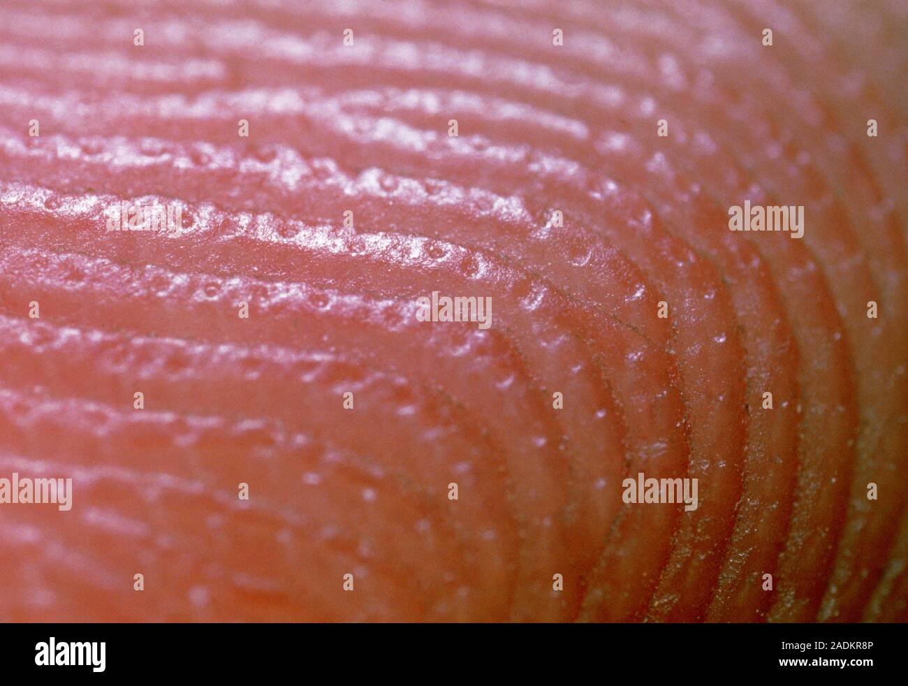 Macrophotograph of the index finger of a young male human showing ...