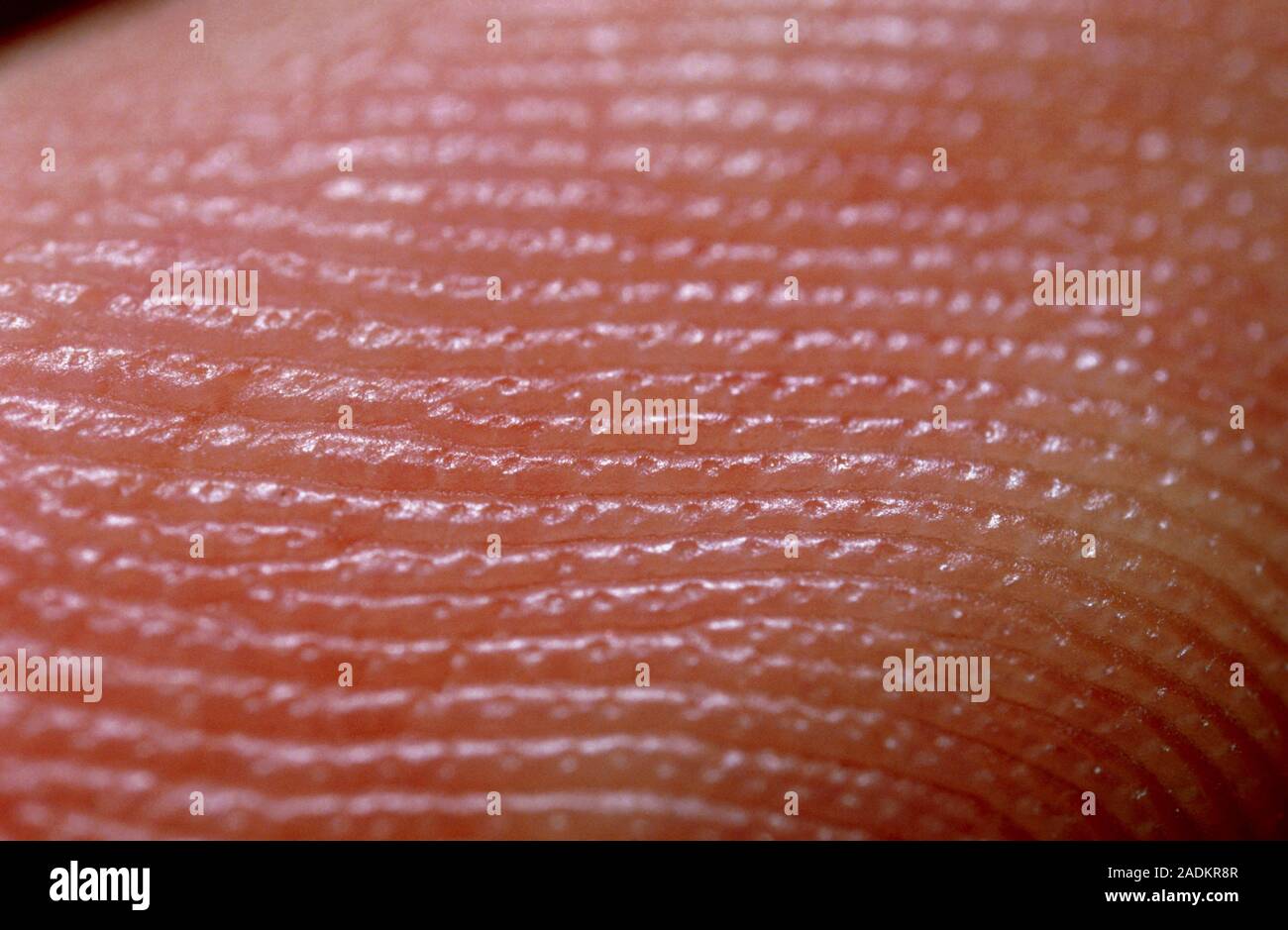 Macrophotograph Of The Index Finger Of A Young Male Human Showing Details Of Skin Ridges In The