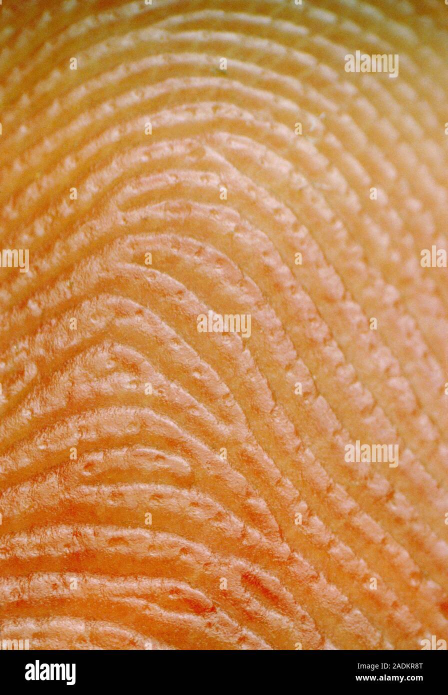 Macrophotograph of the index finger of a young male human showing ...