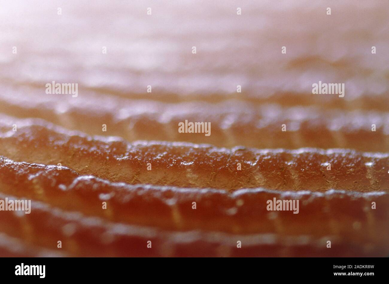 Macrophotograph of the index finger of a young male human showing ...