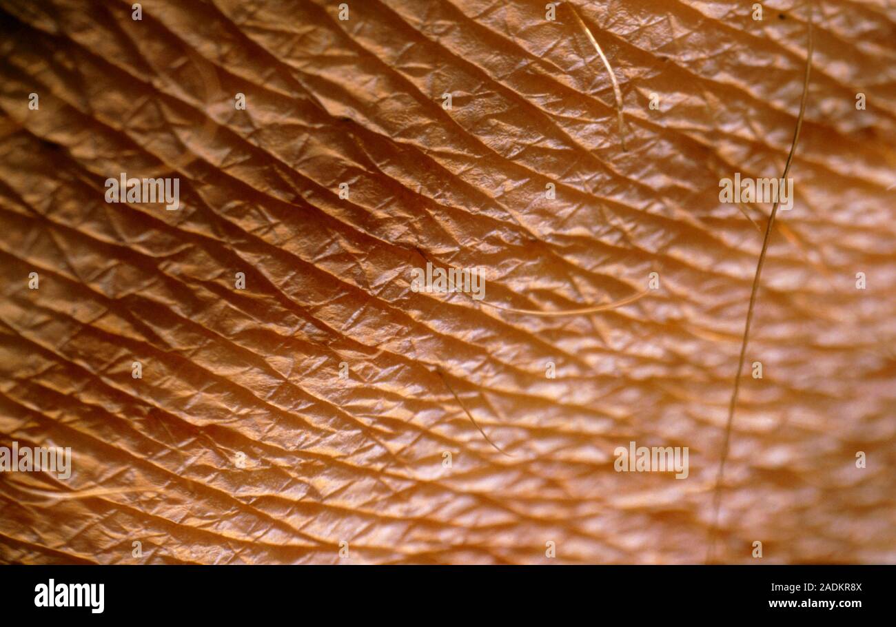 Macrophotograph of the skin on the back of the hand of a young male ...