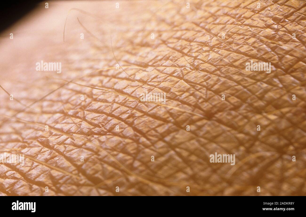Macrophotograph of the skin on the back of the hand of a young male ...