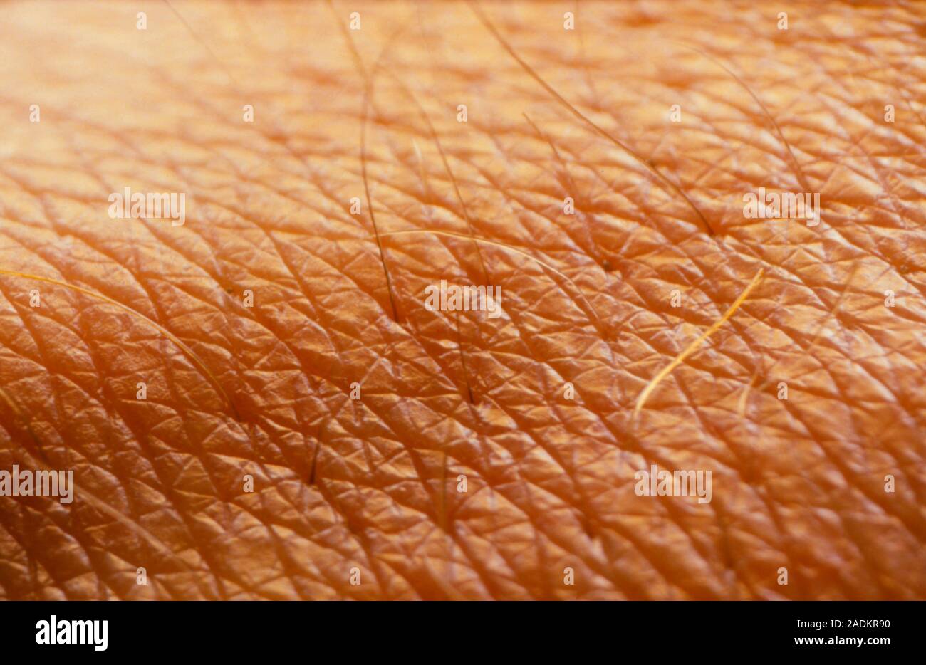 Macrophotograph of the skin on the back of the hand of a young male ...