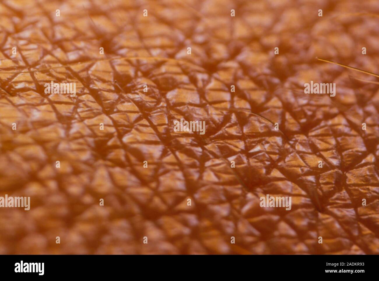 Macrophotograph of the skin on the back of the hand of a young male ...