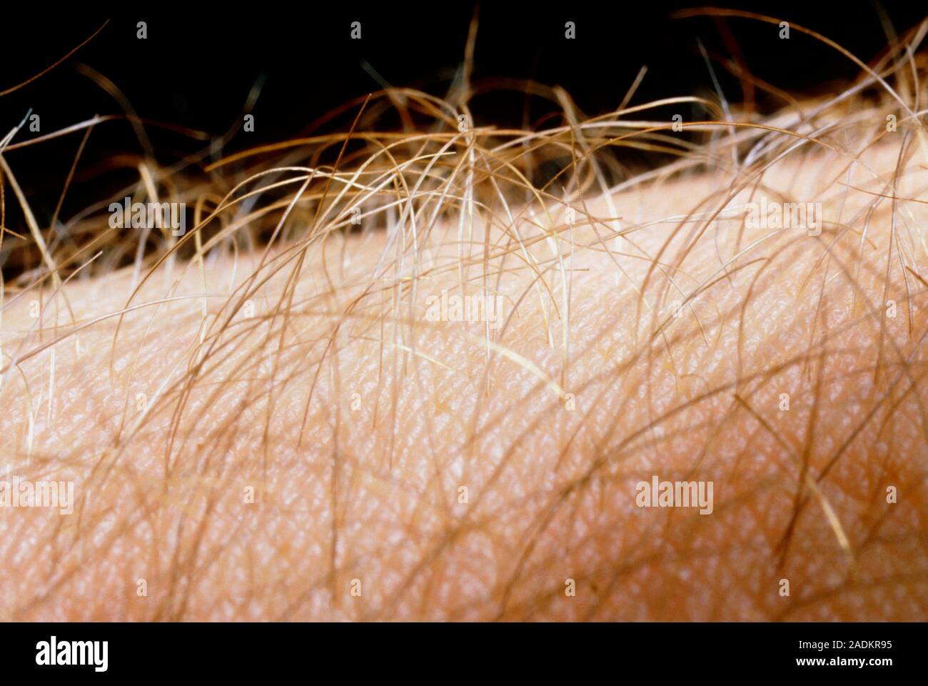 Macrophotograph of the skin on the arm of a young male human showing ...
