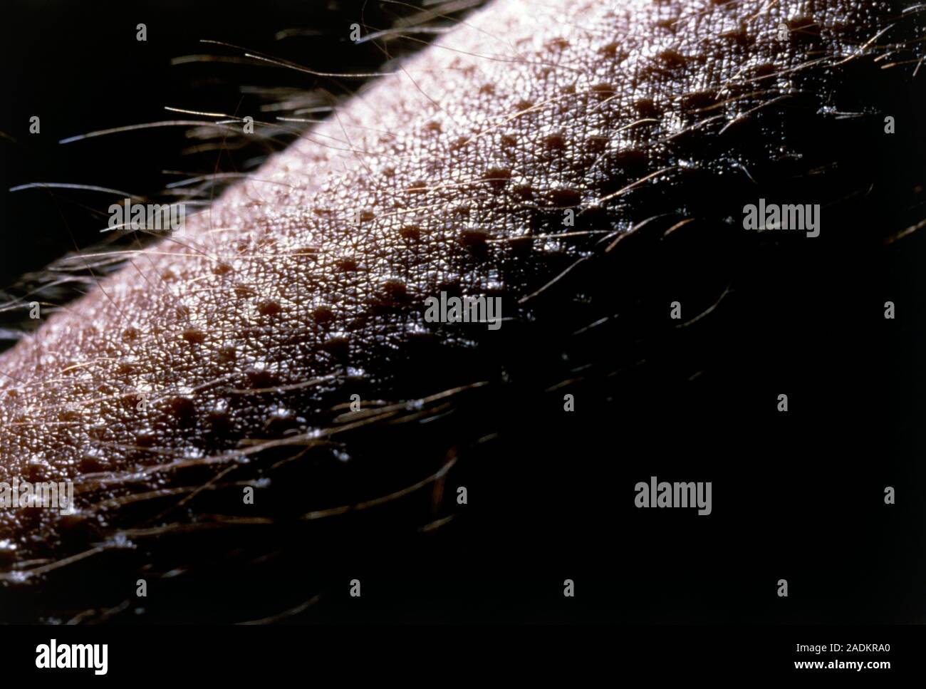 Macrophotograph of the skin on the arm of a young male human showing ...