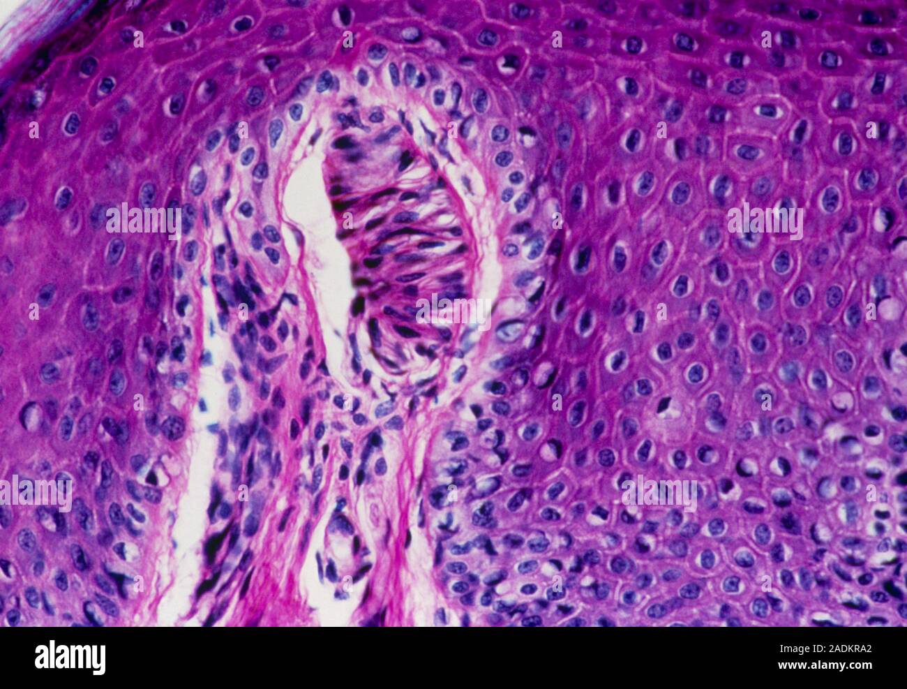 Light micrograph of a section through the skin covering a human ...