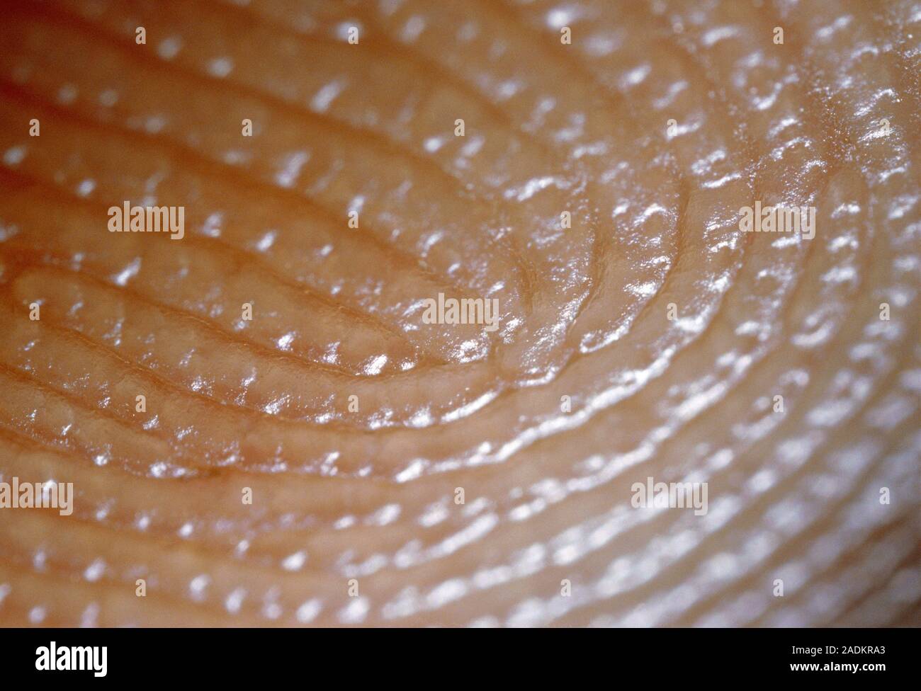 Macrophotograph of the index finger of a young male human showing ...