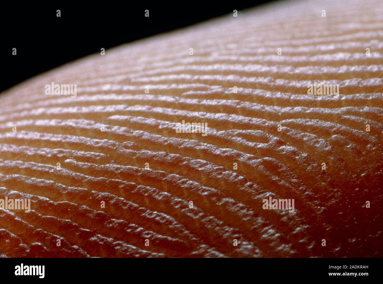 Macrophotograph of the skin on a finger of a young male human showing ...