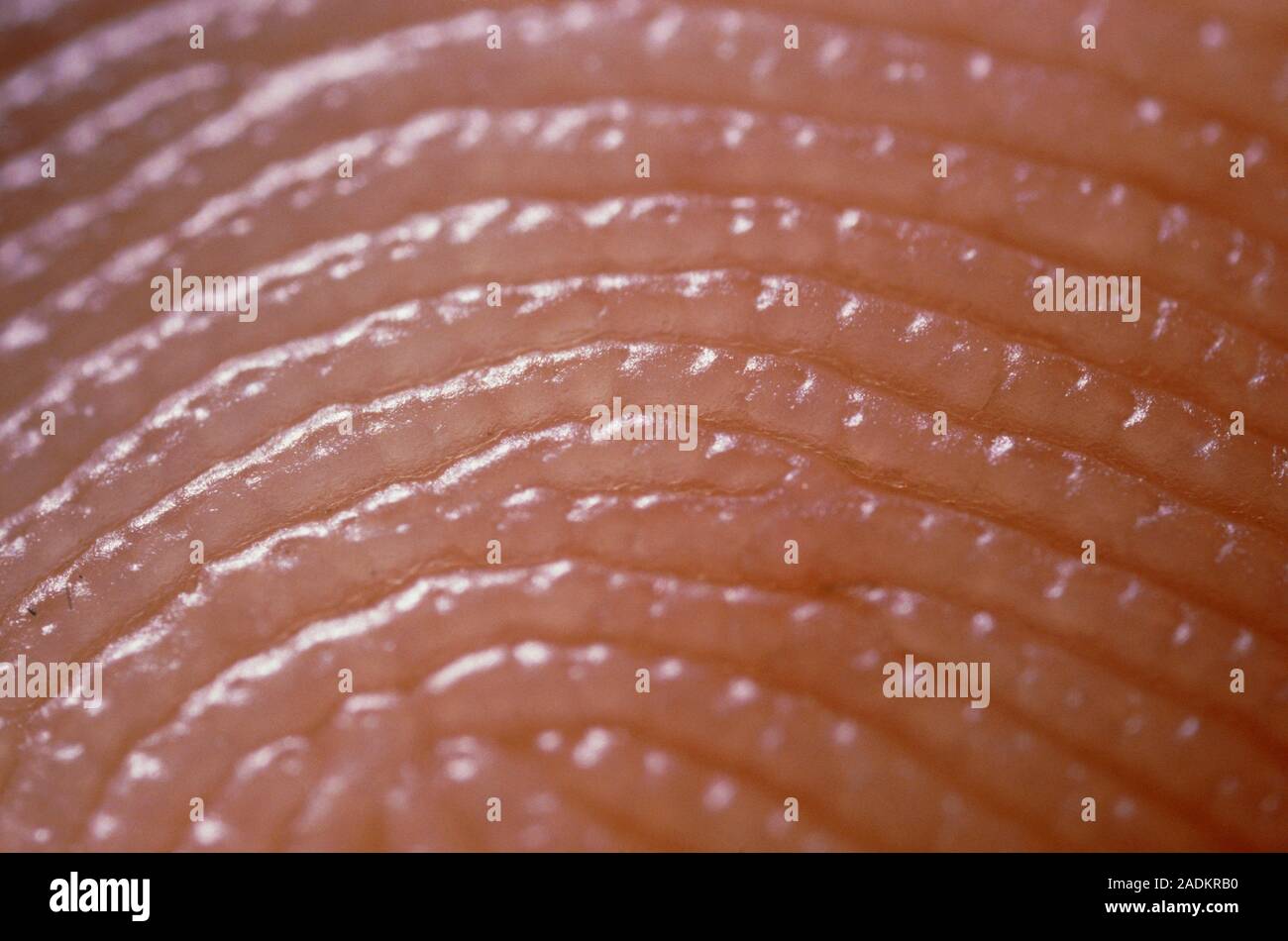 Macrophotograph of the index finger of a young male human showing ...